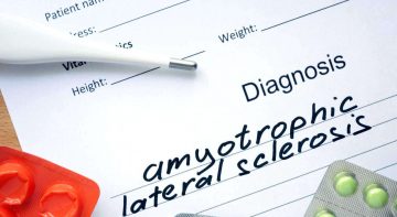 What is Bulbar ALS | ALS Curtis Vance Foundation